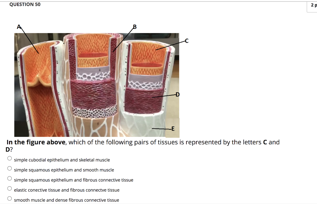 Solved All of the following decrease venous | Chegg.com