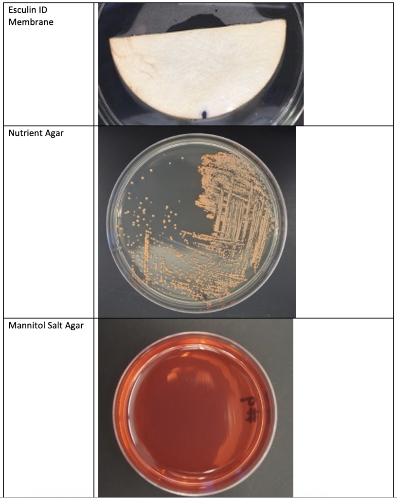Solved Idenitfy the unknown bacteria | Chegg.com
