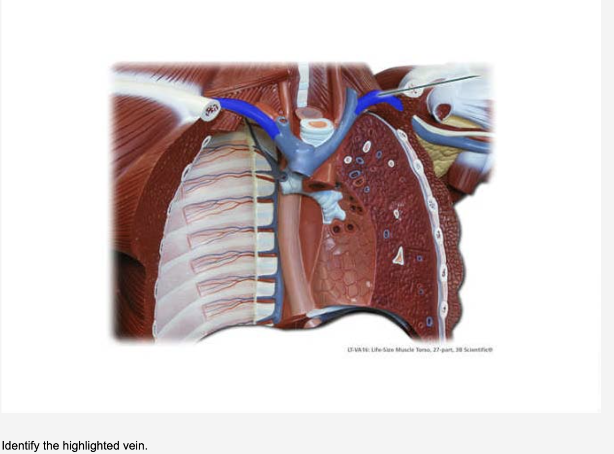 Solved Identify the highlighted vein. Which artery is | Chegg.com