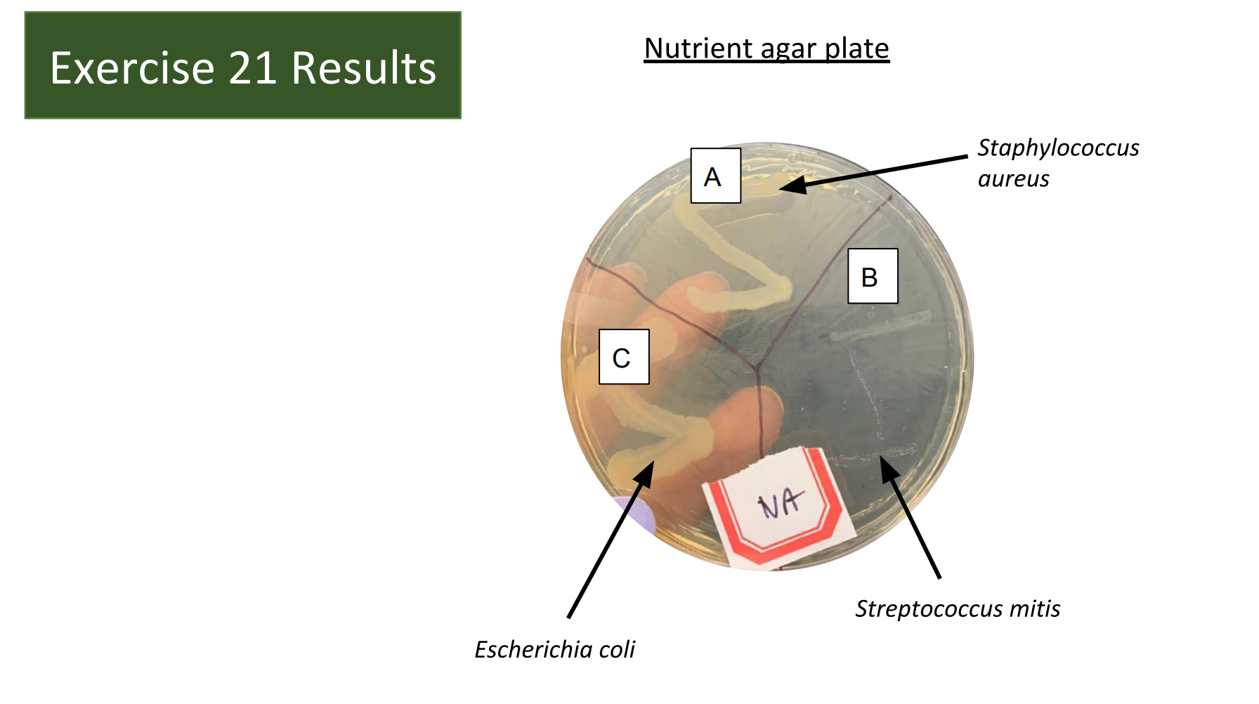 Solved Nutrient agar plate Exercise 21 Results | Chegg.com