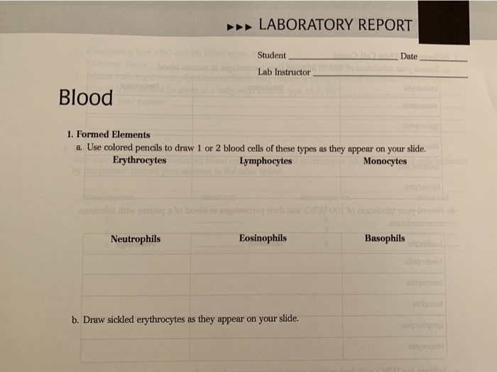 Solved LABORATORY REPORT Student Date Lab Instructor Blood | Chegg.com