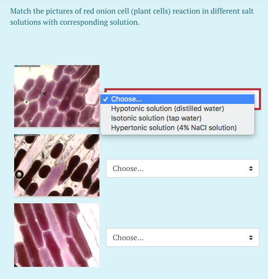 Solved Match the pictures of red onion cell (plant cells) | Chegg.com