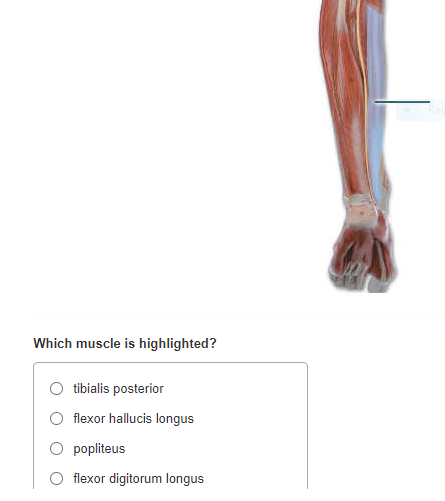 Solved Which muscle is highlighted? O semimembranosus O | Chegg.com
