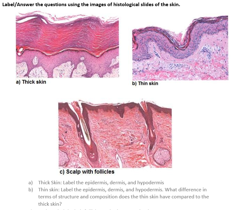 Thick Skin Histology