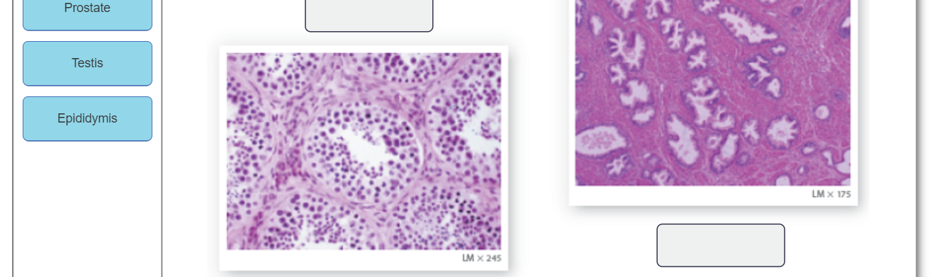 Solved Prostate Testis Epididymis LM X 175 LM X 245 LM X | Chegg.com