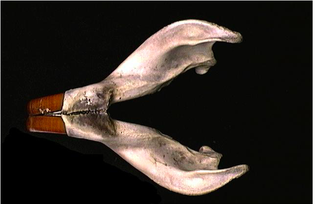 Solved What type of jaw muscle pattern does this image | Chegg.com