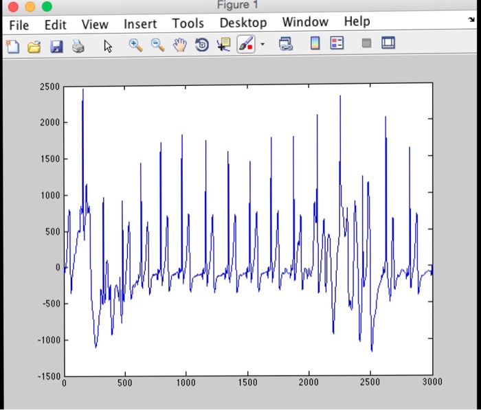 Solved Identify the source of noise artifact in the | Chegg.com
