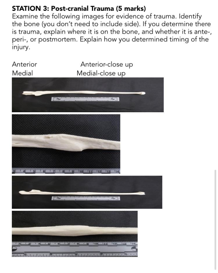 STATION 3: Post-cranial Trauma (5 marks) Examine the | Chegg.com