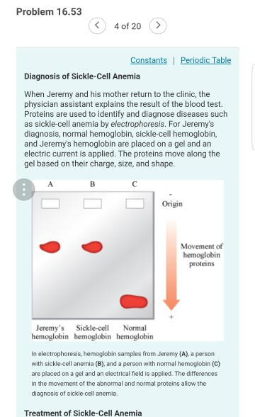 Solved Problem 16.53 4 of 20 > Diagnosis of Sickle-Cell | Chegg.com