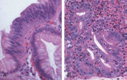 Solved Case Studies on Body Tissues – Epithelium and | Chegg.com