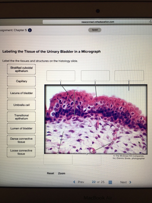 Solved signment: Chapter 5 Labeling the Tissue of the | Chegg.com
