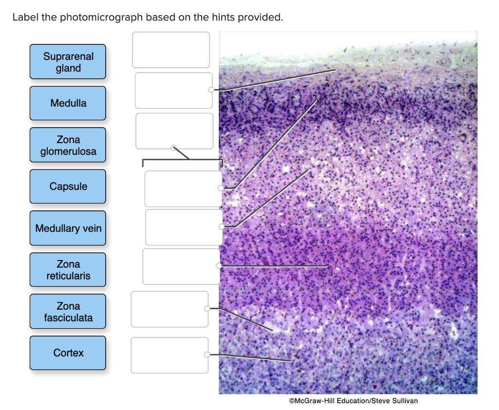 Solved: Label The Photomicrograph Based On The Hints Provi... | Chegg.com