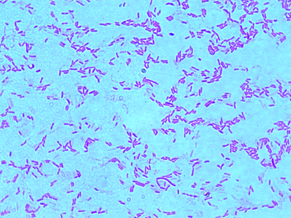 Solved Biochemical Test results Gram positive or gram | Chegg.com