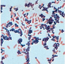 Solved The organisms seen in this Gram stain could be | Chegg.com