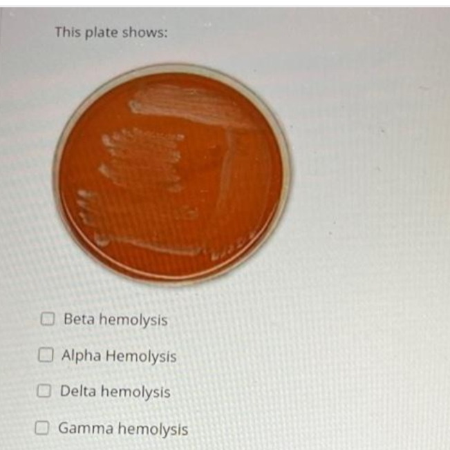 Solved please Fast answer with explanation This plate | Chegg.com