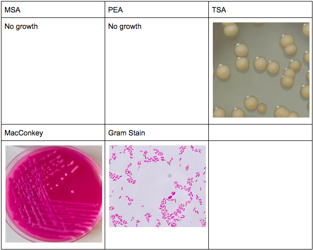 Gram Stain Microscopic Morphology