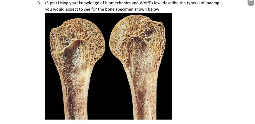 (5 pts) Using your knowledge of biomechanics and | Chegg.com