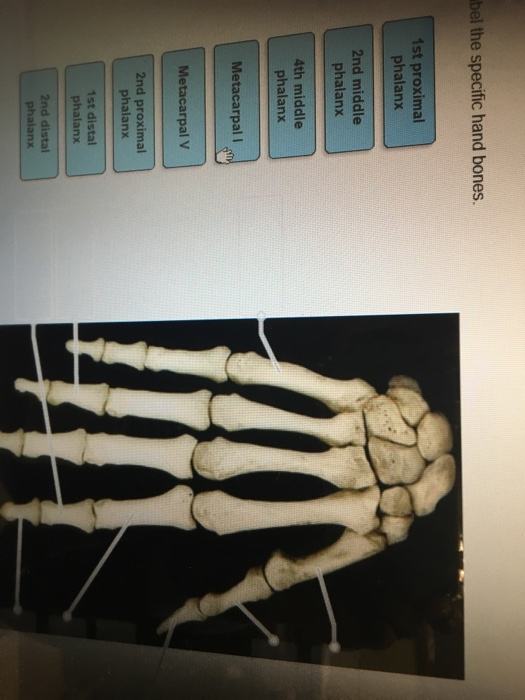 Solved bel the specific hand bones. 1st proximal phalanx 2nd | Chegg.com