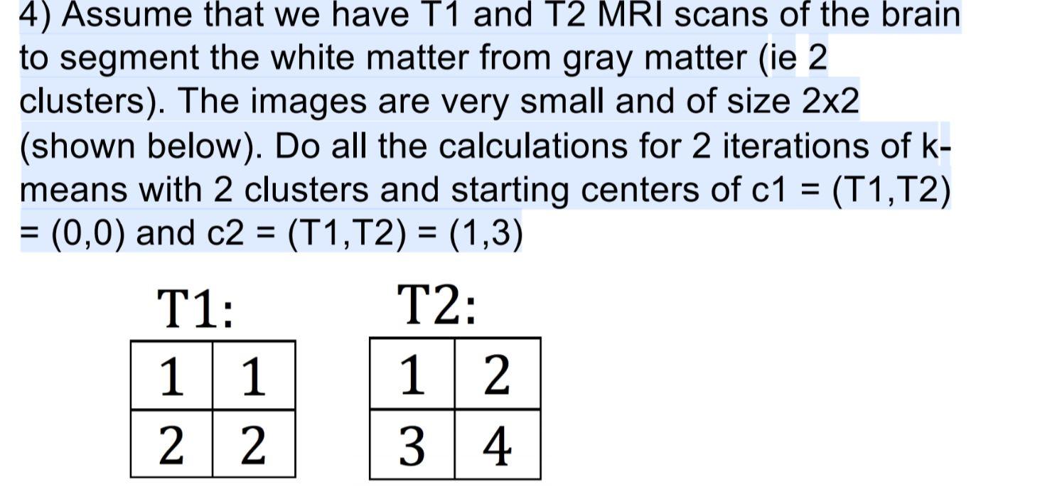 Solved 4) Assume that we have T1 and T2 MRI scans of the | Chegg.com