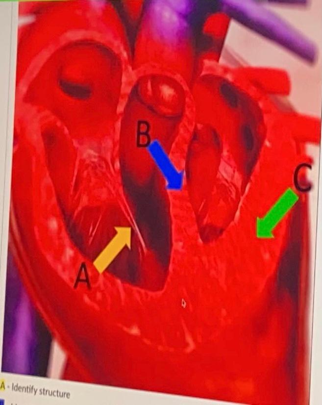 Solved В. А. A. Identify structure | Chegg.com