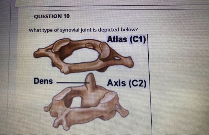Pivot Joint Atlas And Axis