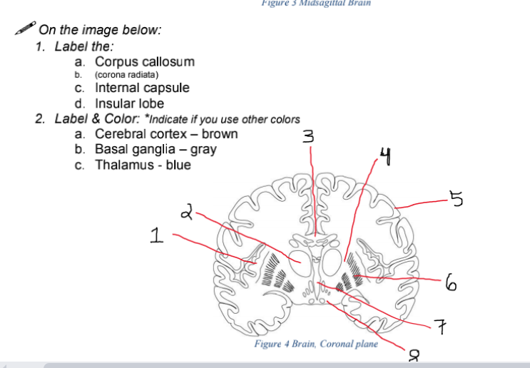 Midsagittal Section Of The Brain Color Coded