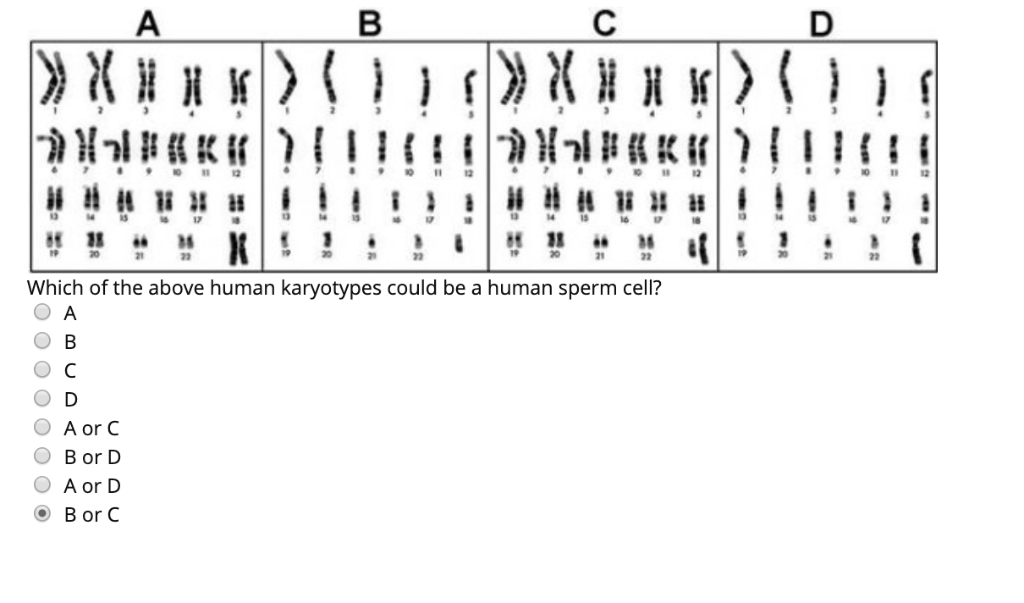 Solved 呤 20 Which Of The Above Human Karyotypes Could Be A