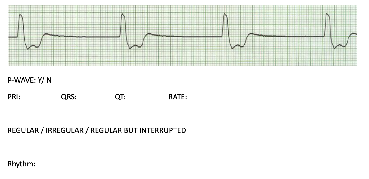 Solved P-WAVE: Y/ N PRI: QRS: QT: RATE: REGULAR / IRREGULAR | Chegg.com