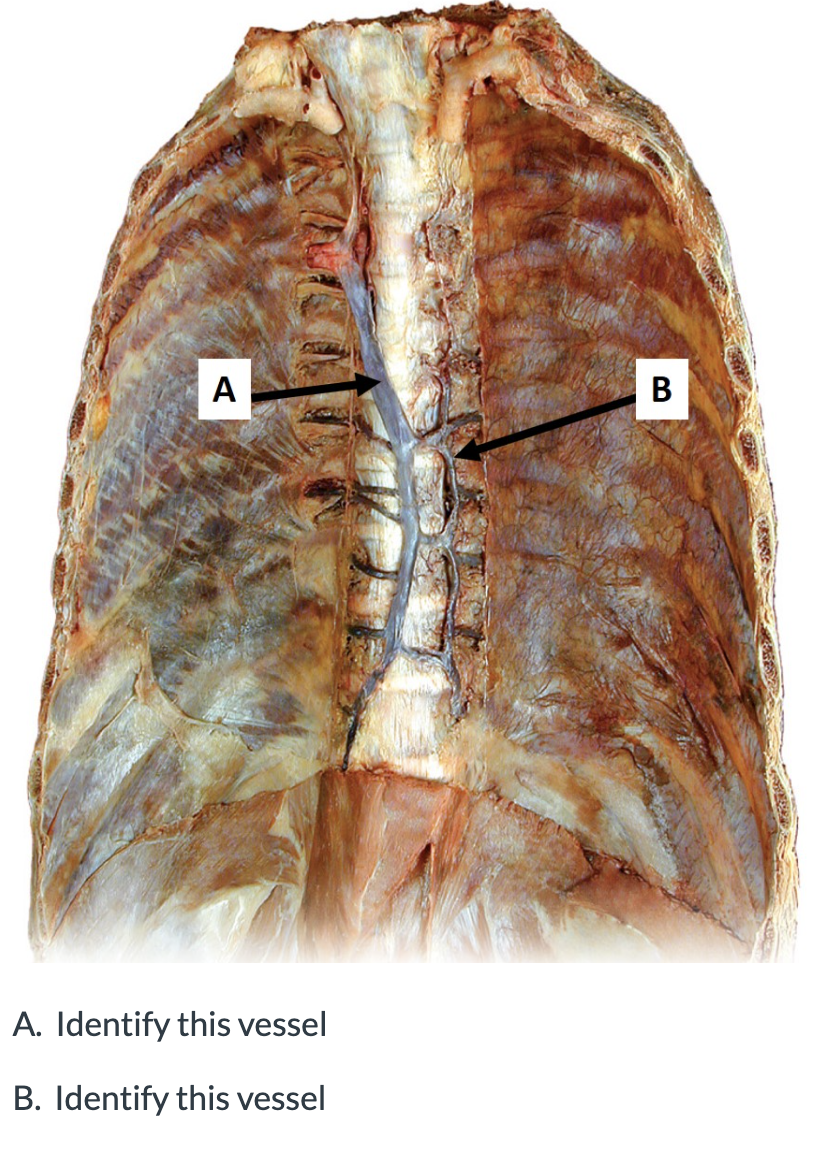 Solved A. Identify this vessel B. Identify this vessel | Chegg.com