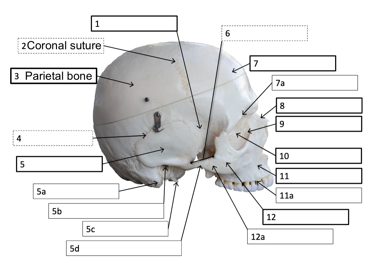 Solved 1 6 2 Coronal suture 7 3 Parietal bone 7a 8 9 ----- 4 | Chegg.com