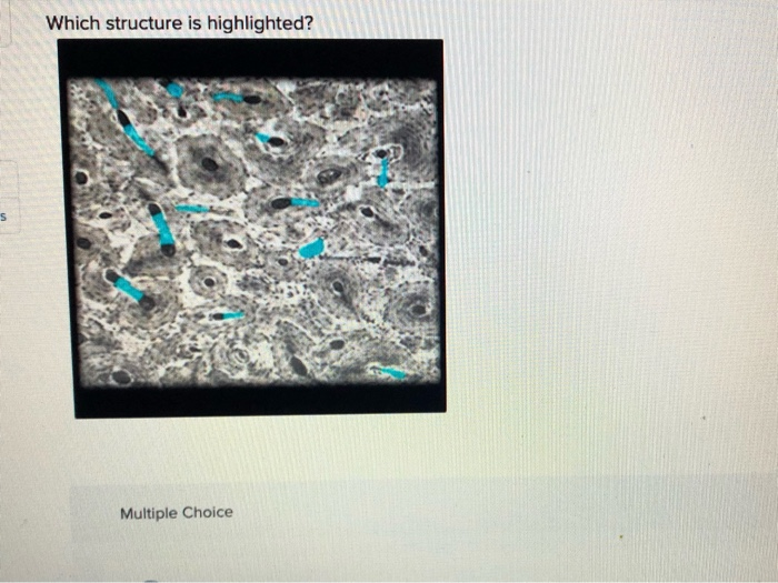 Solved Which structure is highlighted? S Multiple Choice | Chegg.com