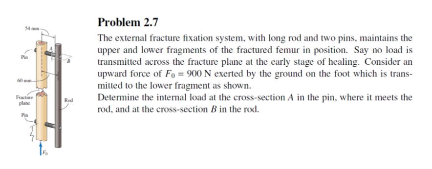 Solved Pin Problem 2.7 The external fracture fixation | Chegg.com