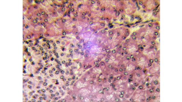 Solved From the Pancreas: Recognize slide at low, medium, | Chegg.com