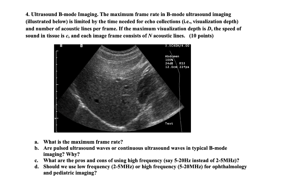 Solved 4. Ultrasound B-mode Imaging. The maximum frame rate | Chegg.com