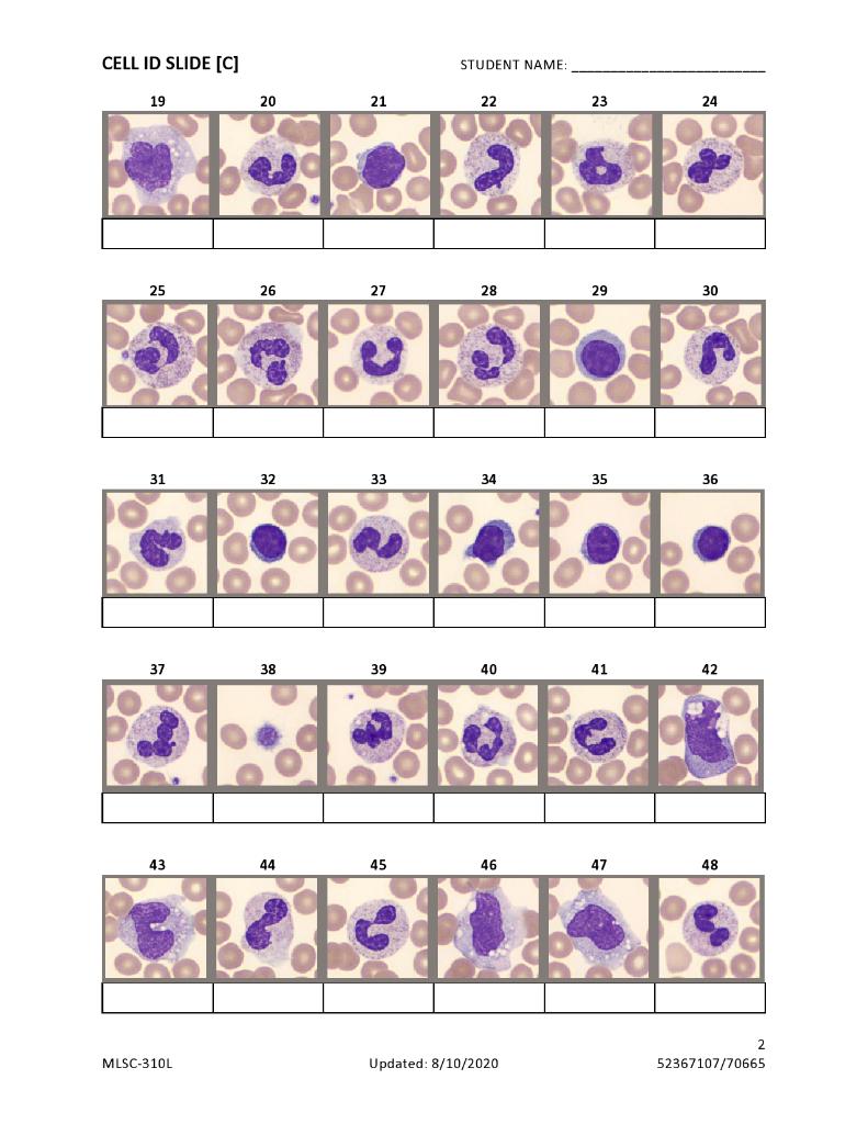Solved CELL ID SLIDE [C] STUDENT NAME: WBC Differential: | Chegg.com