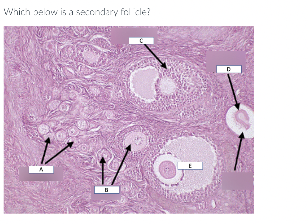 Solved Which below is a secondary follicle? | Chegg.com