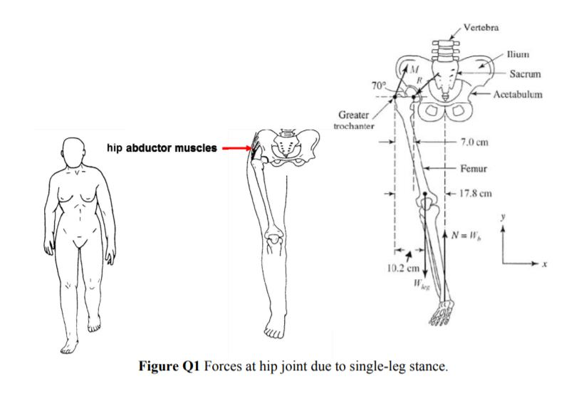 Solved Determine the force exerted by the hip abductor | Chegg.com