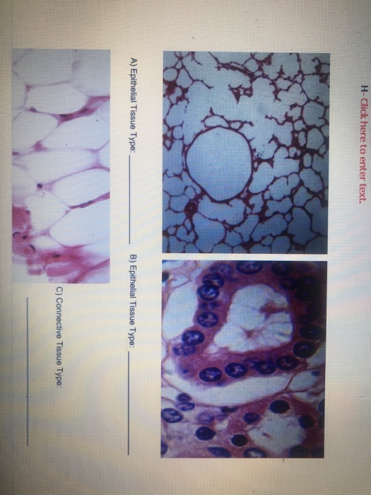 Solved H- Click here to enter text. A) Epithelial Tissue | Chegg.com