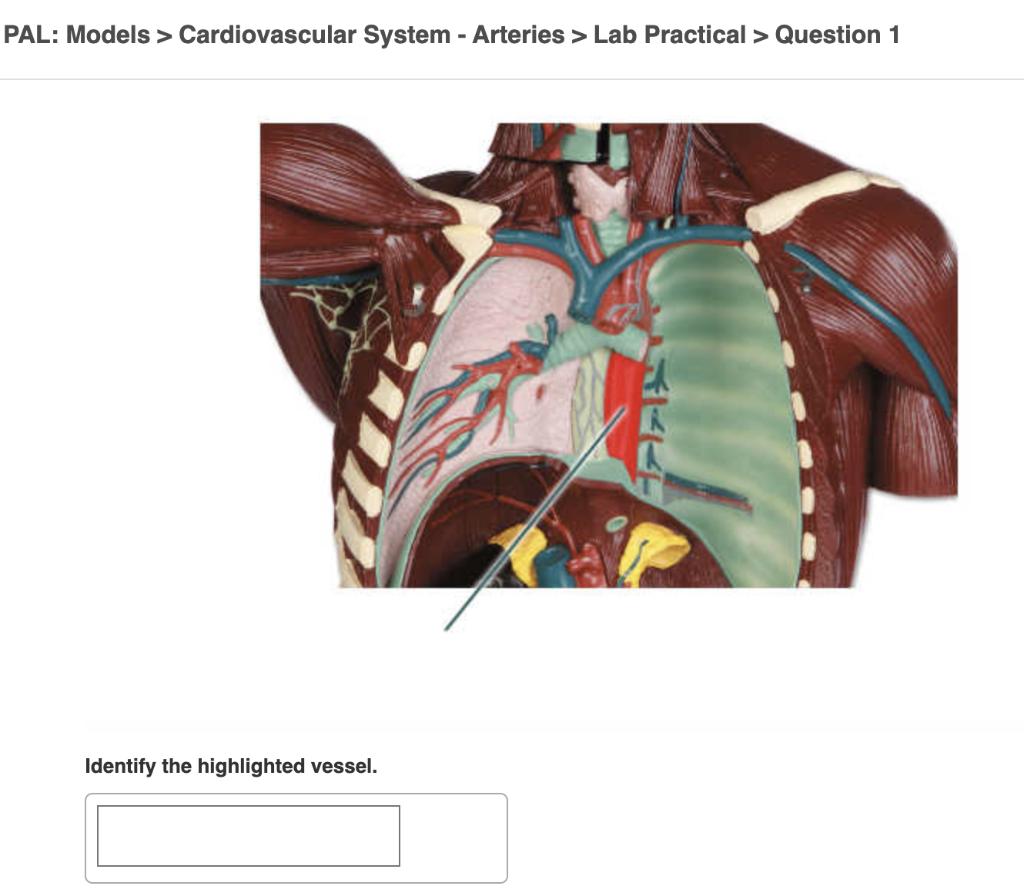 Solved PAL: Cadaver > Cardiovascular System: Blood Vessels > | Chegg.com