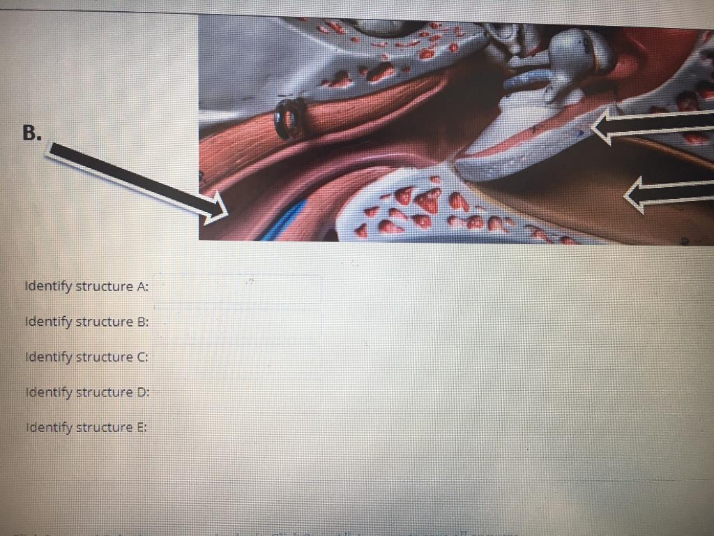 Solved C A D B E B B Identify Structure A Identify