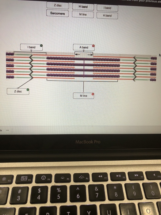 Solved nmyour previous att Z disc H band l band M line A | Chegg.com