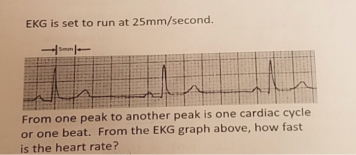 Solved EKG is set to run at 25mm/second From one peak to | Chegg.com