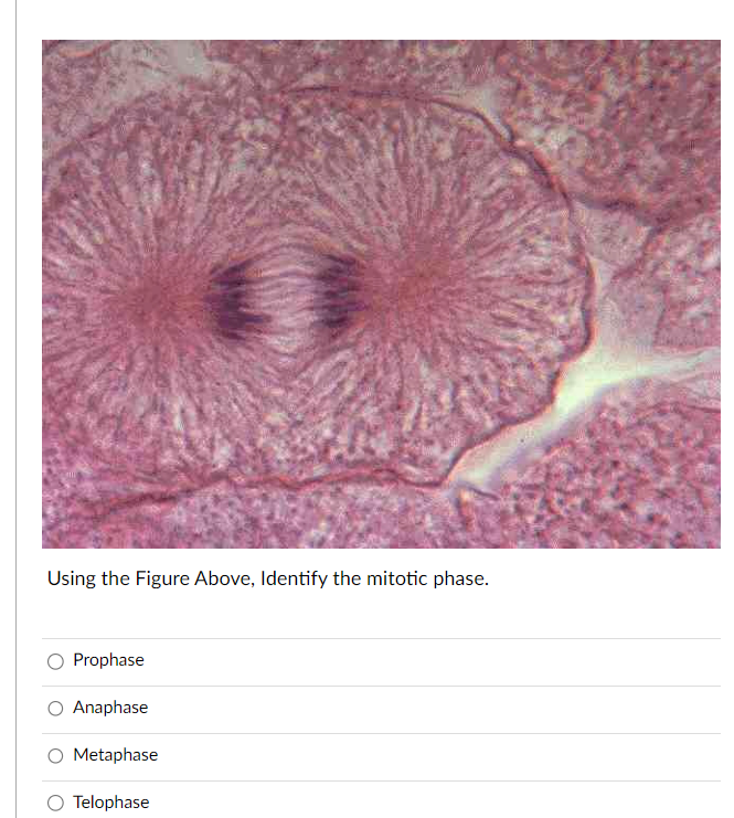 Solved Using the Figure Above, Identify the mitotic | Chegg.com