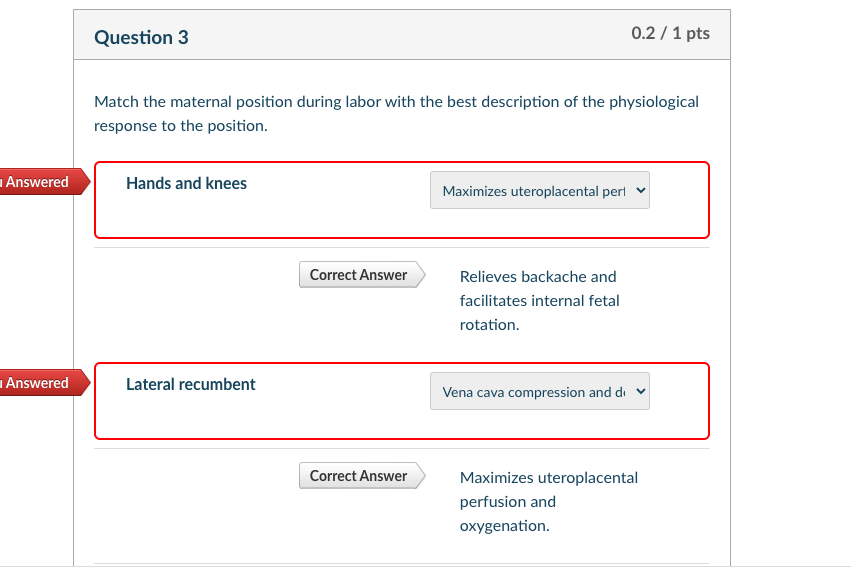 Lateral Recumbent Fetal Position