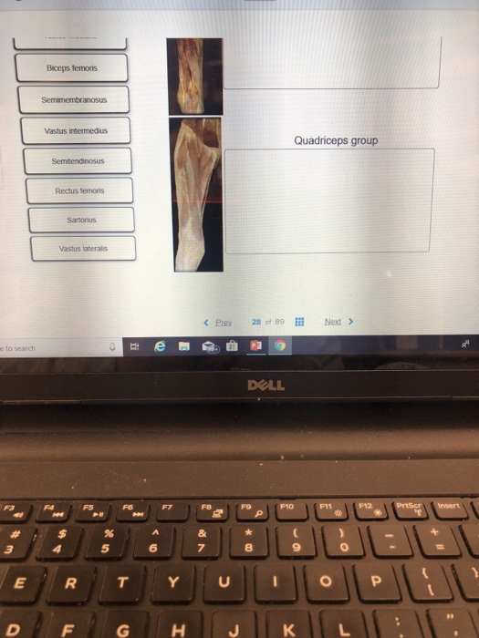 Solved Identify the muscles of the quadriceps and hamstring | Chegg.com Solved Identify the muscles of the quadriceps and hamstring | Chegg.com