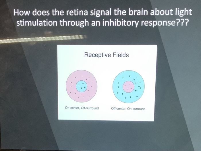 Solved How does the retina signal the brain about light | Chegg.com