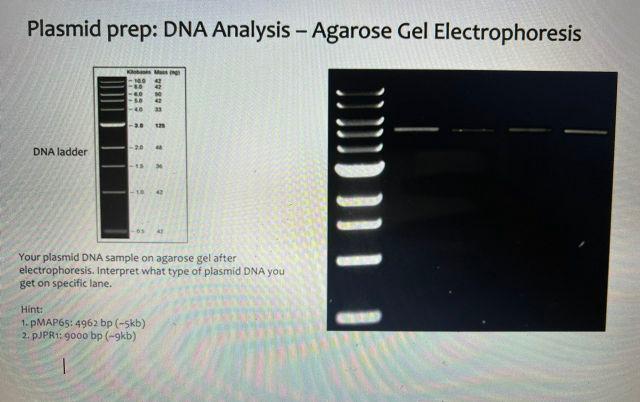 Solved Plasmid prep: DNA Analysis - Agarose Gel | Chegg.com