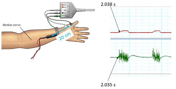 Solved Given the data below, calculate the neuronal | Chegg.com