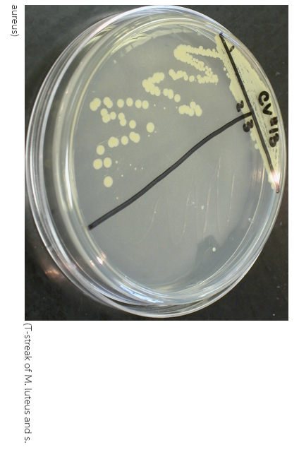 Solved ENVIRONMENTAL SPECIMEN Spread-Plate Technique | Chegg.com