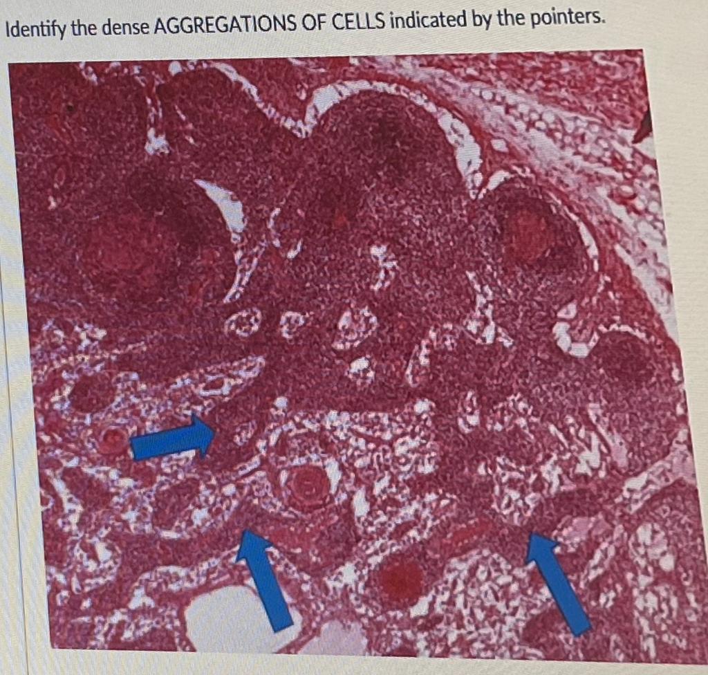 Identify the TISSUE LAYER indicated by the pointer. | Chegg.com